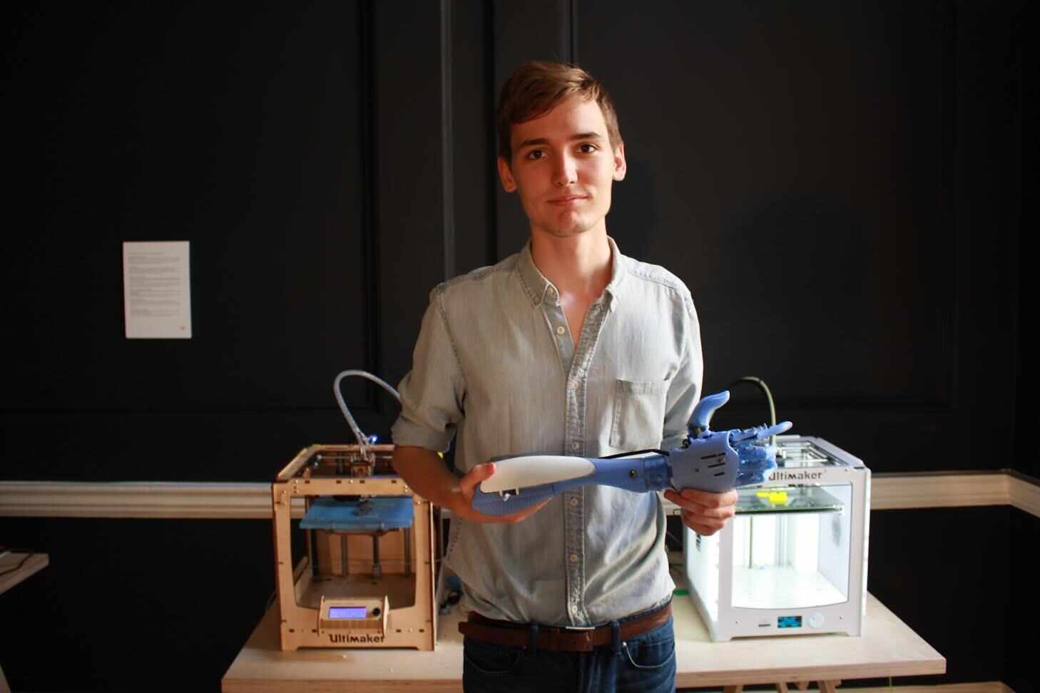 Saving an arm and a leg: the science of prosthetic limbs | Young Post Club
